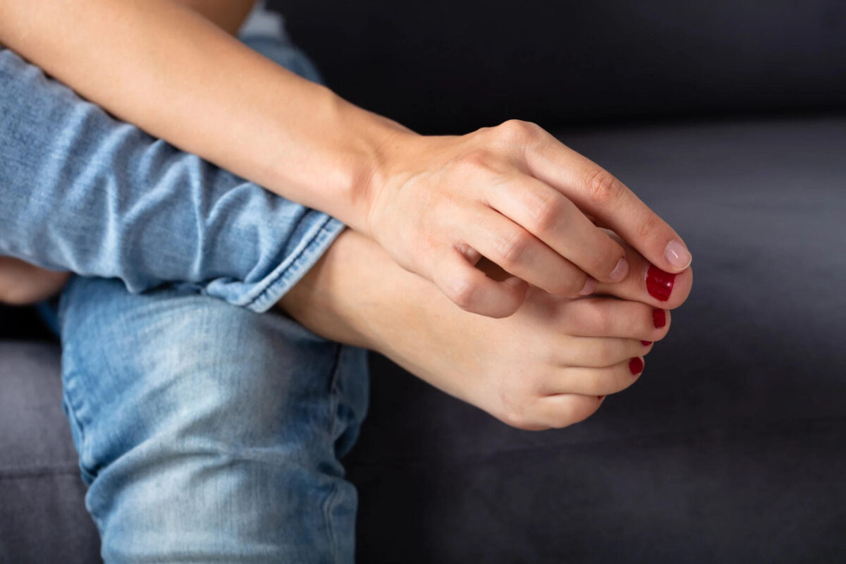 4 Ways to Cope with Deformed Toes