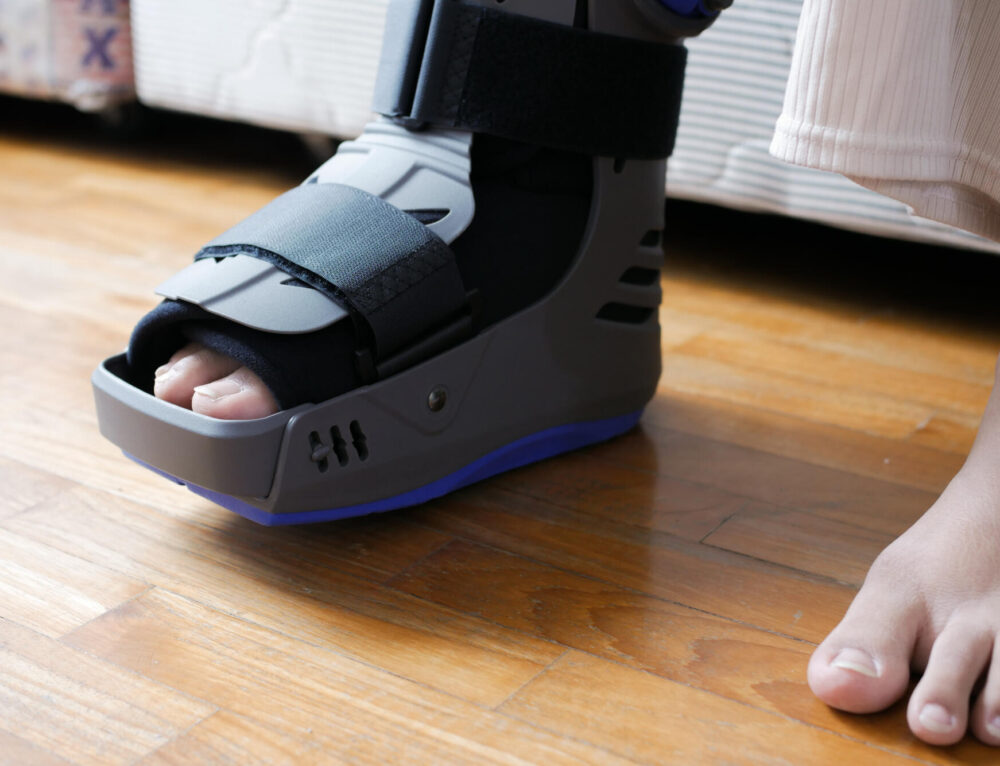 Pain Levels in Foot Reconstruction Surgery: What to Expect